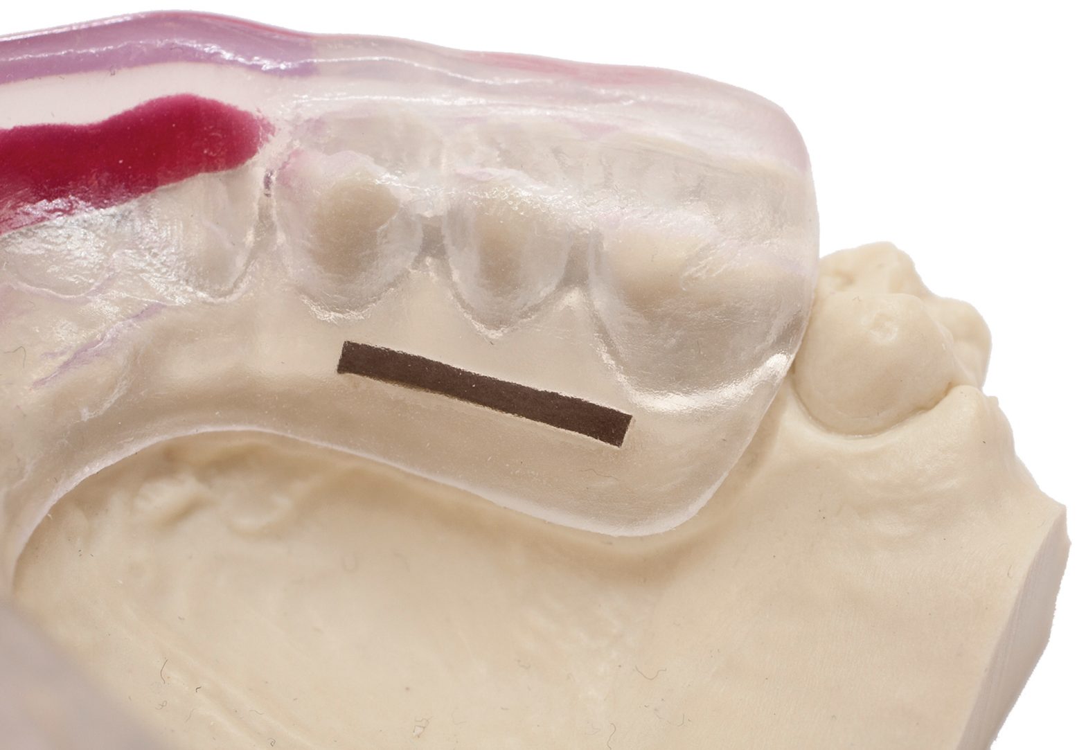 DREVE DRUFOMAT SCAN | WHW