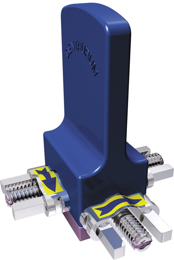 Expansion Screws Archives | WHW